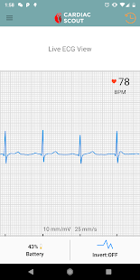 Tải và chơi ECG Research App trên PC (máy tính) cùng NoxPlayer